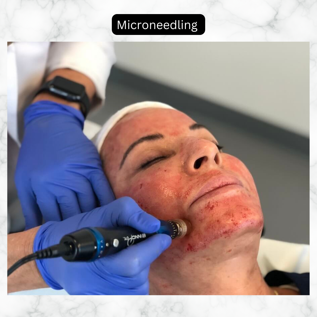 Celluma Light Therapy | Skin Treatments | Evolation Electrolysis, Laser & Wellness Clinic